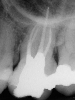 Case Studies Archive - Huddersfield Endodontics