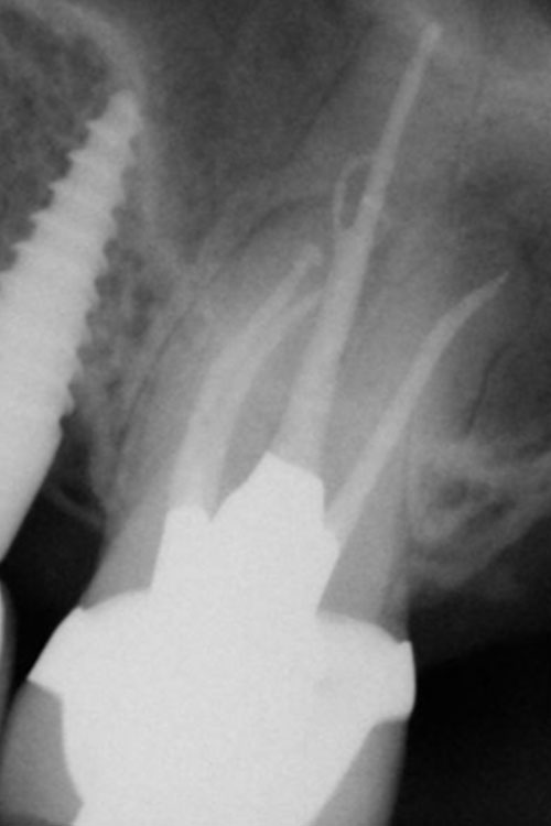 More Case Studies - Huddersfield Endodontics | Root Canal Treatments