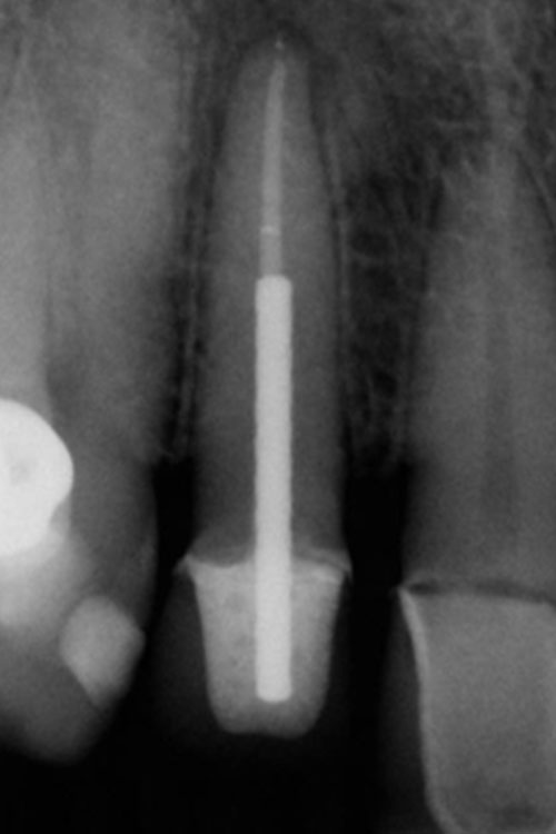 More Case Studies - Huddersfield Endodontics | Root Canal Treatments